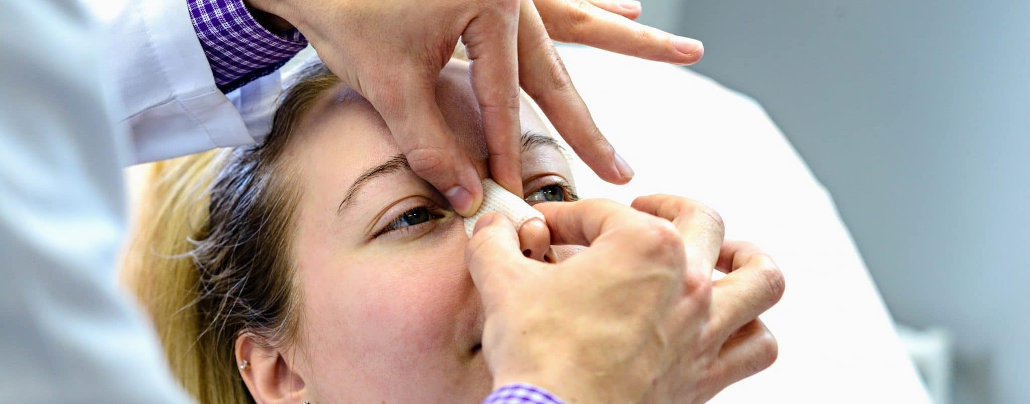 Nasal Fracture | Dr. Stolovitzky